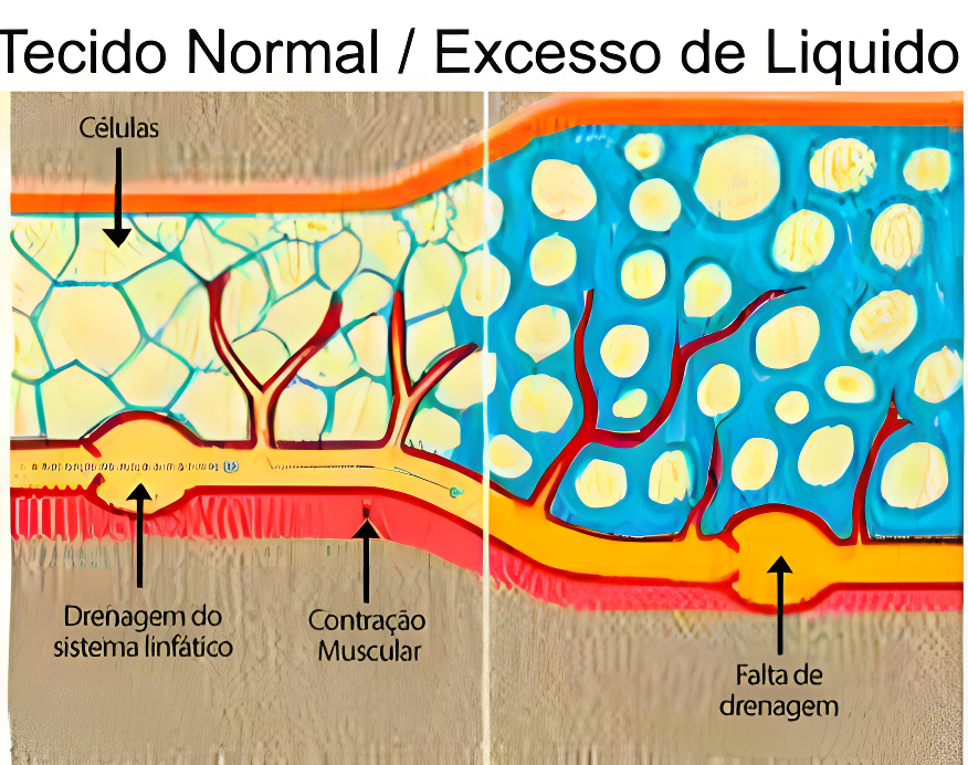 Drenagem Linfática: Desintoxicação Profunda para uma Vida Mais Leve e ...