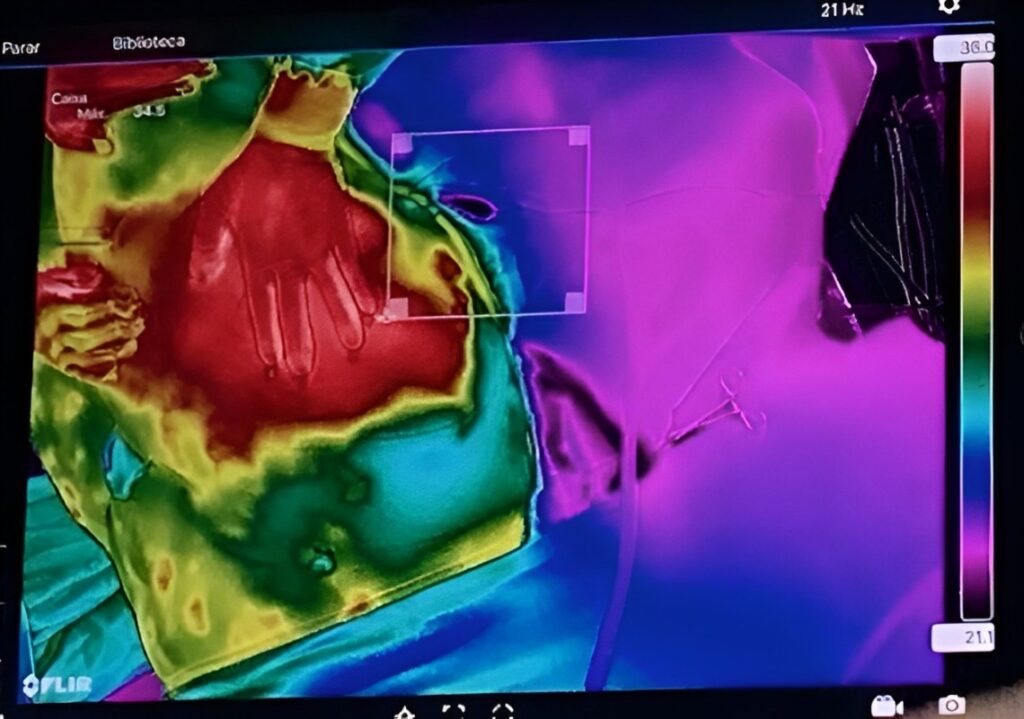 As aplicações da Termografia na Medicina da sua Clínica – Holper | Para ...